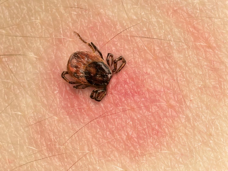 How to properly inspect for ticks in Massachusetts